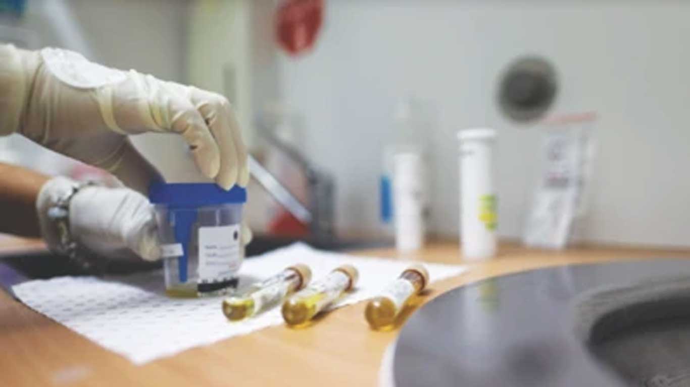 How drug testing kits contribute to site safety – Drug Alert Australia